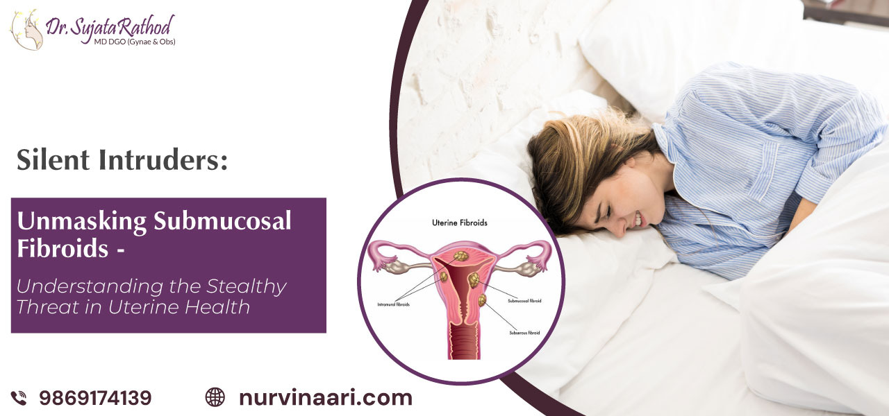 Submucosal Fibroids: Symptoms, Causes & Treatment