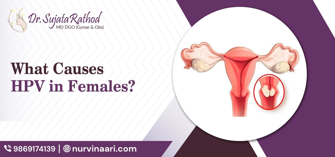 What Causes HPV in Females?