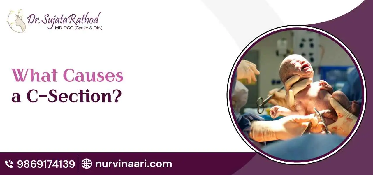 What Causes a C-Section? Learn More Gynecologist in Thane